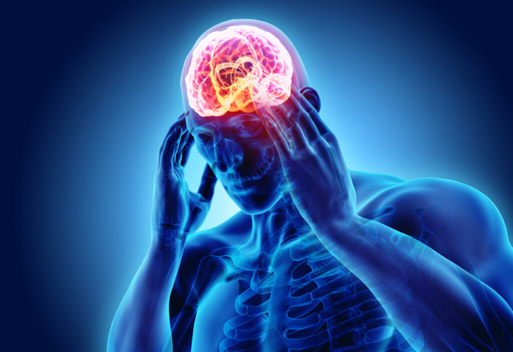 Migraine: Possible Causes, Symptoms & Treatment Options