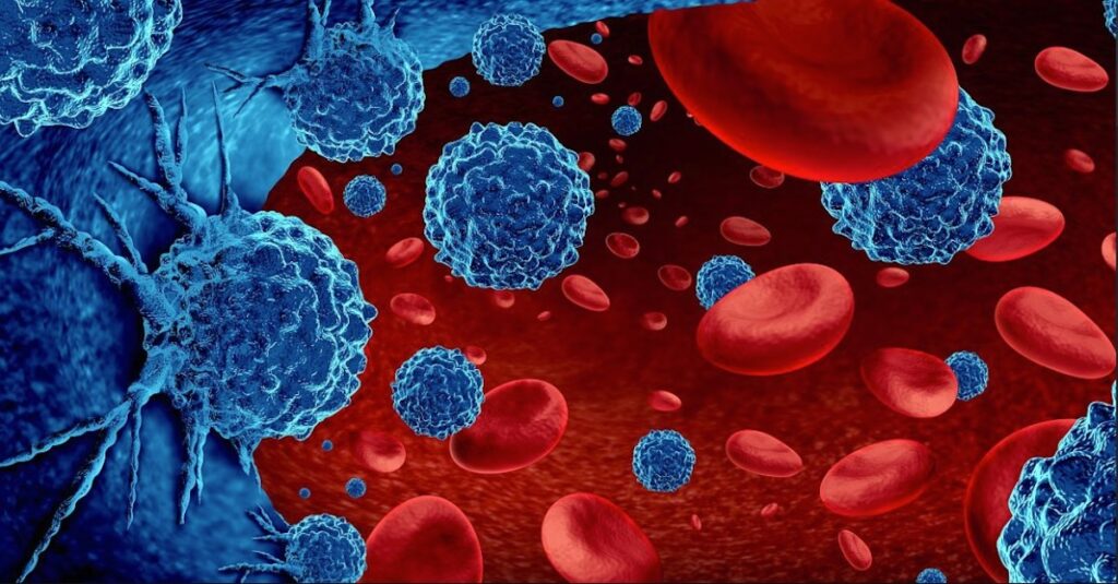 Bone Marrow Cancer: Causes, Symptoms & Treatment Options