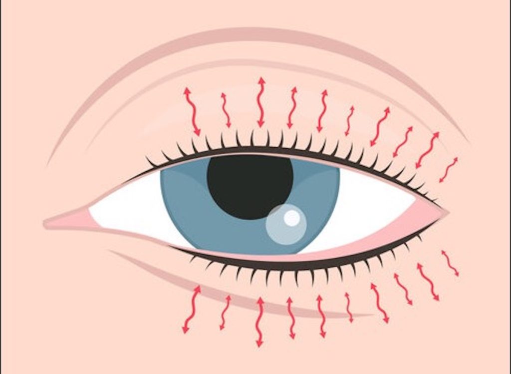Eye Twitching: Causes, Symptoms & Treatment Options