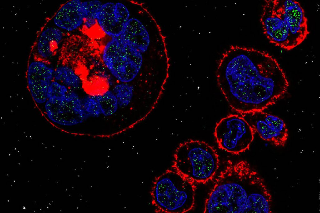 What to Know About Graft-versus-host Disease (GVHD)